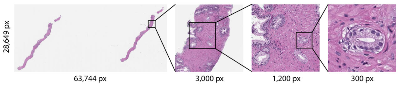 Digital Pathology Slides | Scientific Computing and Data