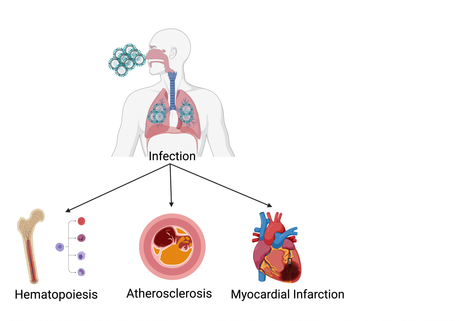 Infection and Cardiovascular Disease - Swirski Lab